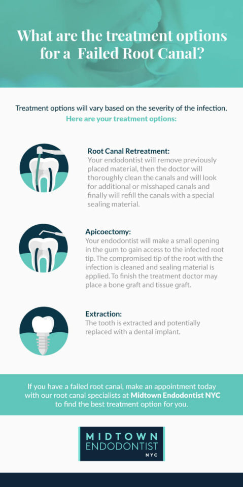 Failed Root Canal | Symptoms & Treatment Options | MENYC