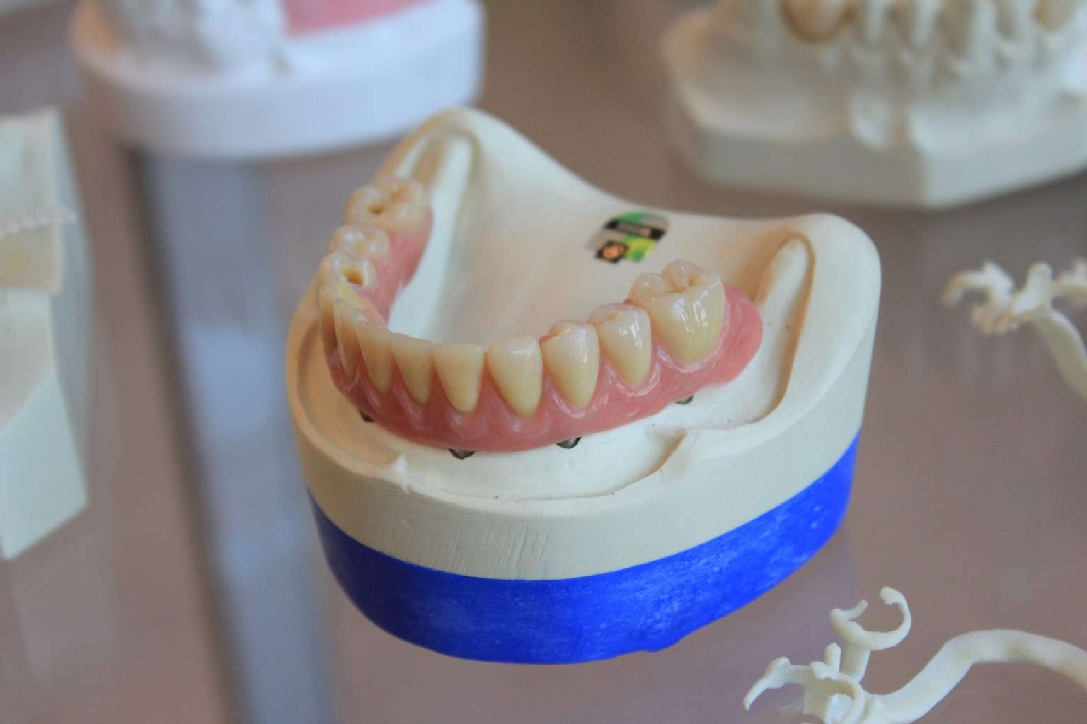 How to Know if You Have an Abscessed Tooth | Midtown Endodontist NYC