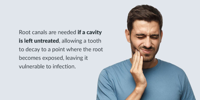 How Do I Know I Need a Root Canal | MENYC